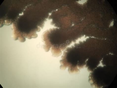 Branched Bacterial Colonies Under The Microscope Stock Image Image Of Microbiology Beuatiful