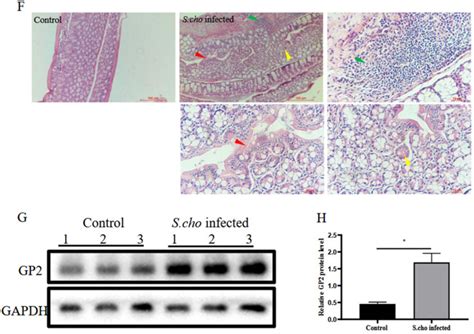 Myd88 Mediates Colitis And Rankl Induced Microfold Cell Differentiation Pmc