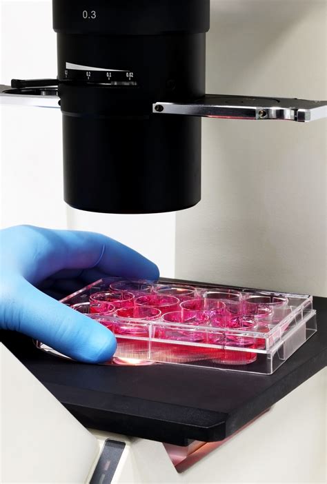 Plaque Reduction Neutralization Tests Prnt And The Development Of New Antiviral Drugs