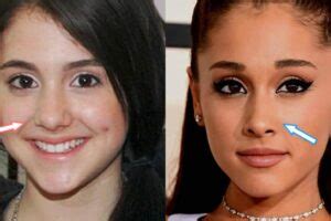 Ariana Grande Nose Job Separating Fact From Fiction Celebrity