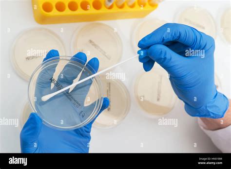 Bacterial Swab Samples At Ronald Alvarez Blog