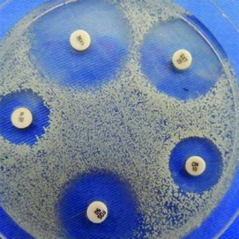 Methicillin Resistant Staphylococcus Aureus Test Download Scientific