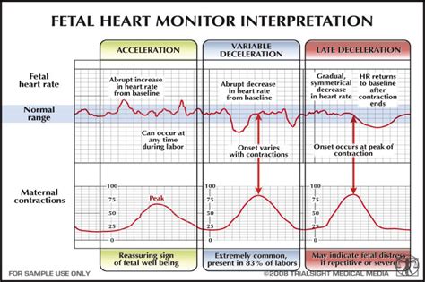 Early Variable Late Decels Early Reassuring Variable Cord Compression Late Decreased