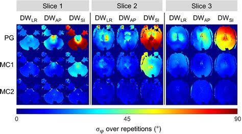 Motion‐compensated Diffusion Encoding In Multi‐shot Human Brain