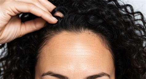 Learn All About Scalp Reduction Surgery And Its Types Stemsontx