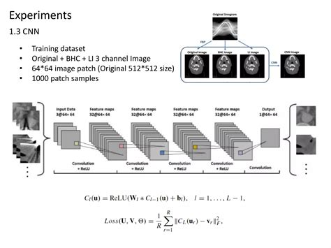 Convolutional Neural Network Based Metal Artifact Reduction In X Ray Computed Tomography Ppt