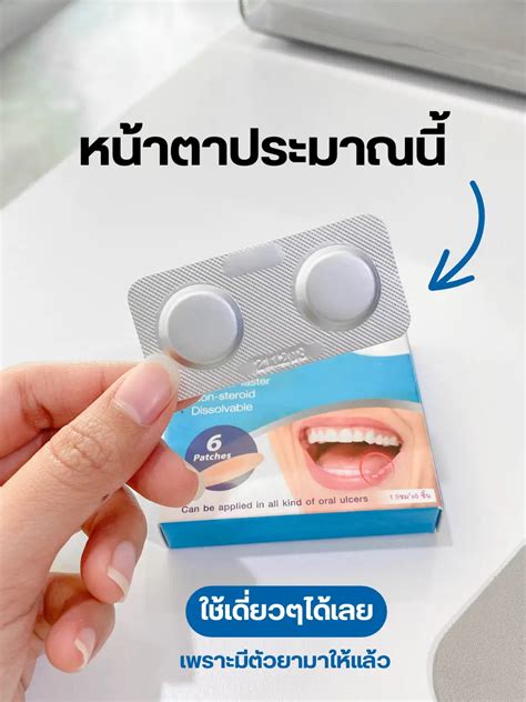 หมดปัญหา ยาแก้ร้อนในติดทุกอย่างยกเว้นติดแผล แก้ได้ด้วย…🫦🩹 แกลเลอรี