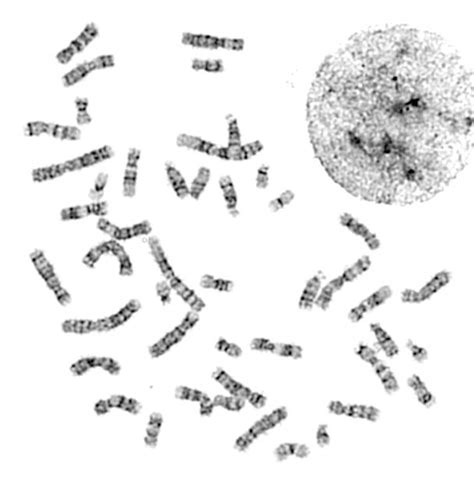 Chromosome Detection2bounding Box Object Detection Dataset V1 2023