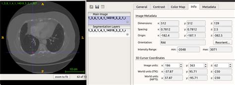 detection conversion between monai box and nndetection box · issue