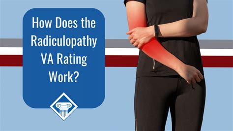 Lumbar And Cervical Radiculopathy Va Benefits