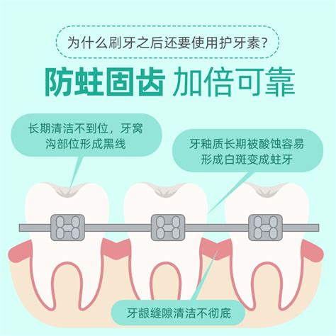 日本狮王龋克菲正畸护牙素含氟牙齿脱矿防护牙齿白斑再矿化牙膏虎窝淘