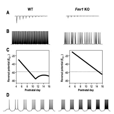 Electrophysiological Alterations In Fragile X Syndrome A The Local