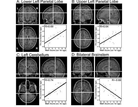 Correlations Between Math Scores And Fractional Anisotropy Math Scores