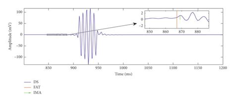 Typical Preprocess Signal Of Cshf Blue Line And Associated Parameters
