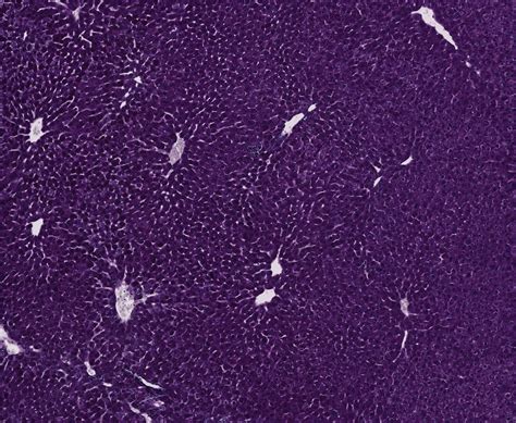 Aid In Analysis Of Pas Stained Slides Using Qupath Image Analysis