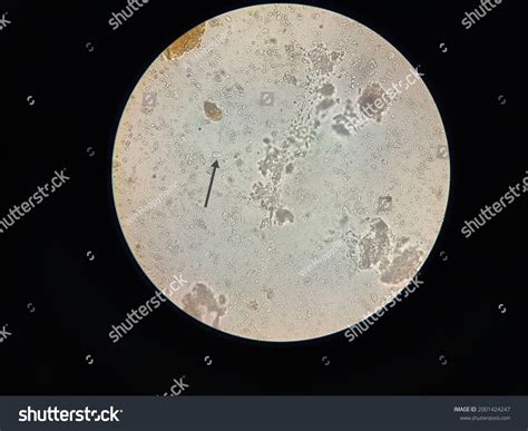 Giardia Under Microscope At Isabella Rae Blog