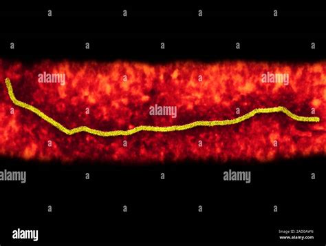 Nipah Virus Particle Transmission Electron Micrograph Tem Of Nipah Virus Niv Particle
