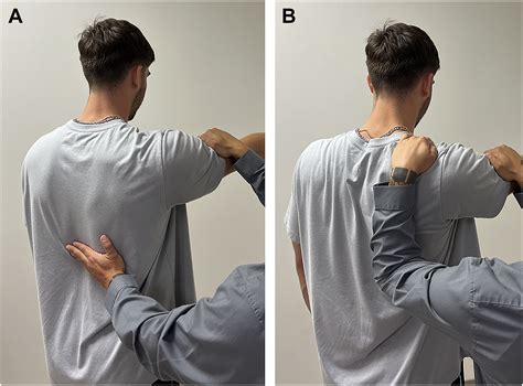 Managing Scapular Dyskinesis Physical Medicine And Rehabilitation Clinics