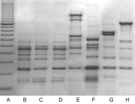 An Example Of Repetitive Element PCR Enterobacterial Repetitive Download Scientific Diagram