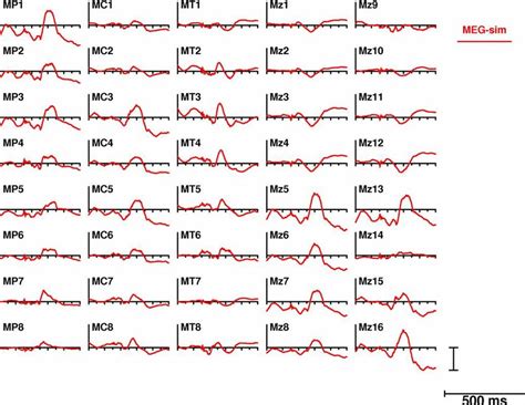 Simulated Meg For Distributed Source Fitted To Ecog Data Of Fig1 For A Download Scientific