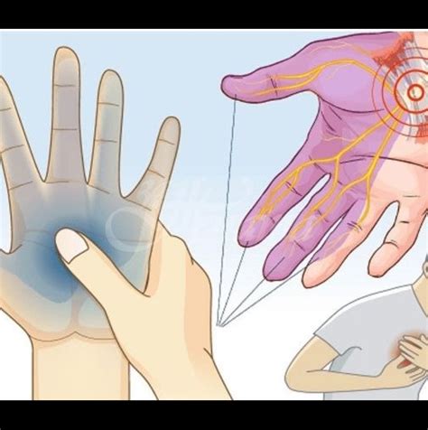 Ако ви изтръпват така ръцете през нощта трябва да вземете мерки За Жената