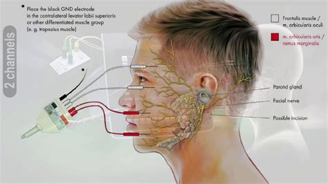 Electromyography Face