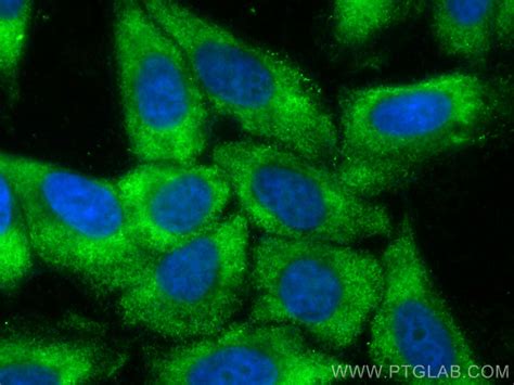 GPT Antibody CL Proteintech