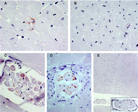 Immunohistochemical Detection Of Prp Sc In Heart And Skeletal Muscle Download Scientific