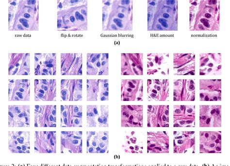 deep learning with permutation invariant operator for multi instance
