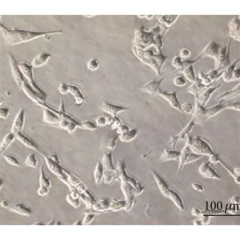 Kupffer Cells Isolation And Identification Kupffer Cells Were Isolated