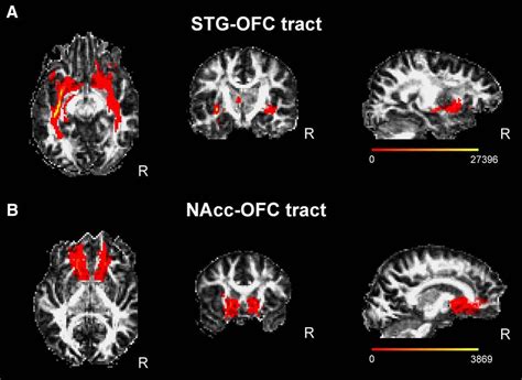 Individual Differences In Music Perception And Sensitivity A Look At