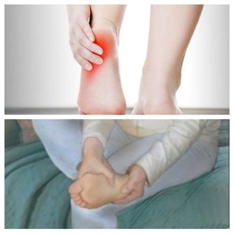 Баба Рада Официјална страница Ако имате ШИЛЦИ ВО ПЕТА ќе Ви посочам неколку природни МНОГУ