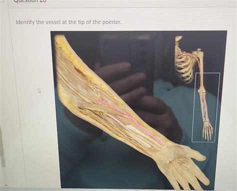 solved y the vessel at the tip of the pointer identify the
