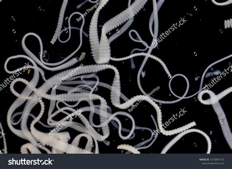 Tapeworm Under A Microscope
