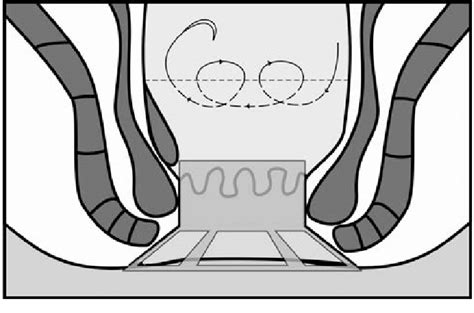 Application Of The Purse String Suture Download Scientific Diagram