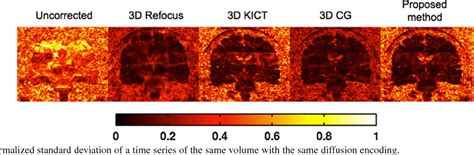 Figure 1 From Motion Induced Phase Error Estimation And Correction In