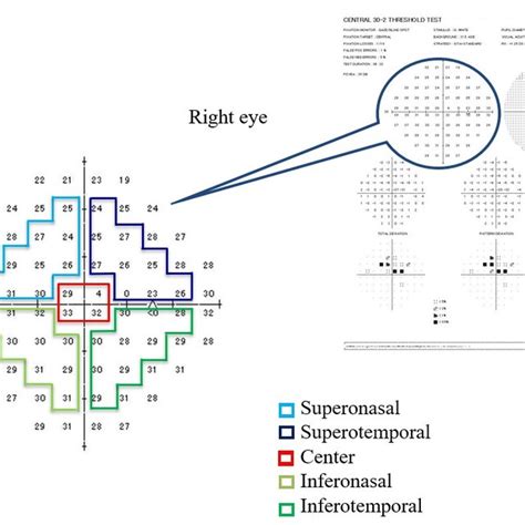 Humphrey Field Analyzer Central 30 2 Program Hfa 30 2 Corresponding