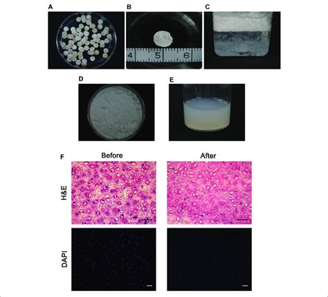 Production Of The Decellularized Cartilage Extracellular Matrix A