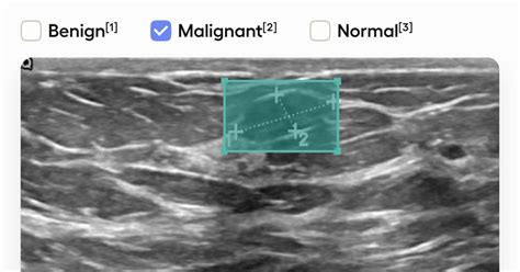 Interactive OCR With Tesseract And Label Studio Label Studio