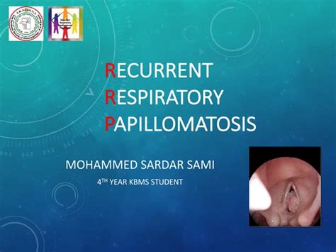 Recurrent Respiratory Papillomatosis Pdf