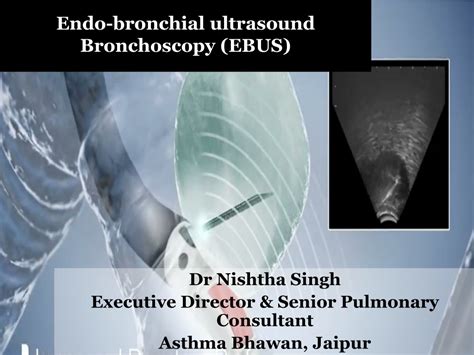 Ppt Advanced Interventional Procedure Of Ebus Dr Nishtha Singh