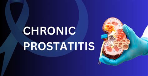 Chronic Prostatitis Causes Symptoms Diagnosis And Treatment