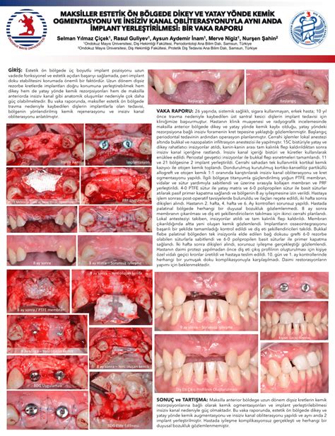 Pdf Vertical And Horizontal Ridge Augmentation And Incisive Canal Obliteration In The