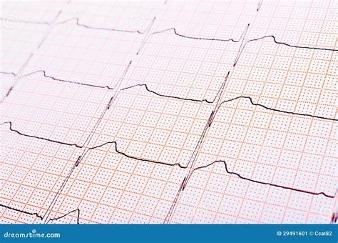 Heart Rhythm Chart Stock Image Image 29491601