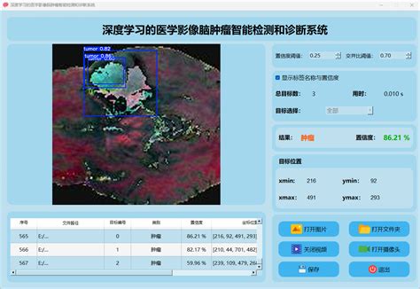 基于yolov8深度学习的脑肿瘤智能检测系统设计与实现pyqt5界面数据集训练代码 中猿创新 7zcode