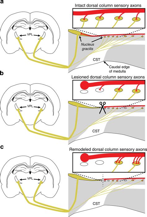 Proprioceptive Circuit Recovery Is Driven By Plasticity Of Primary