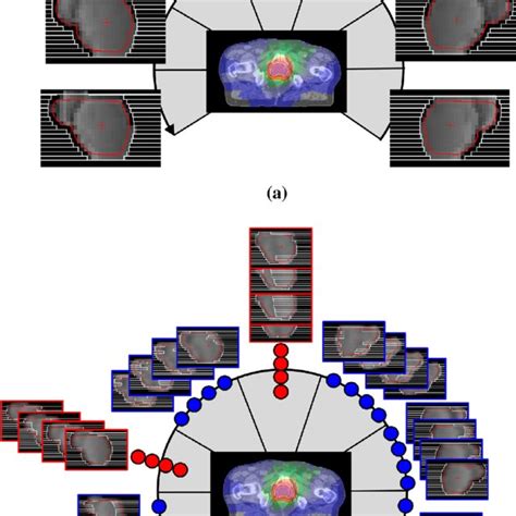Schematic Diagram Showing The Concept Of Hybrid Imrt And Vmat
