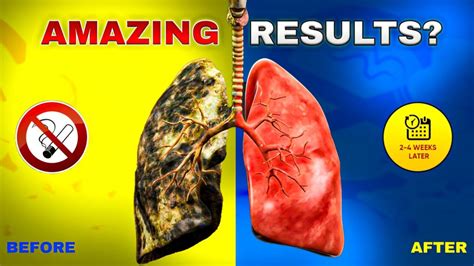 Quit Smoking Timeline What Happens To Your Body