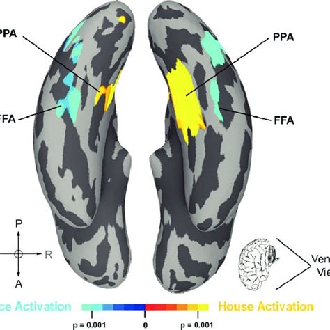 Comparison Of Ppa Versus Ffa Connectivity In Control Participants Is Download Scientific