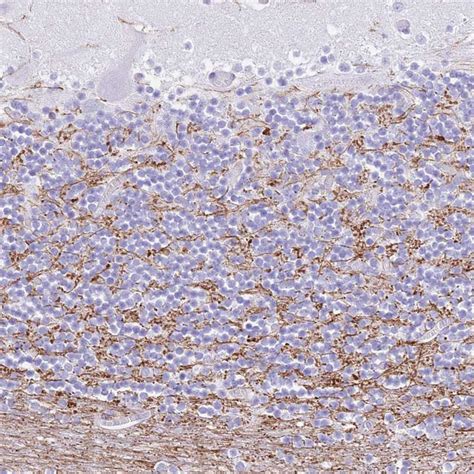Rabbit Polyclonal Anti Efhd2 Antibody Buy For Research Highly